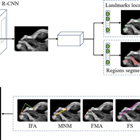 Ultrasound Images Showing The Manual Measurement Of Each Facial Profile Download Scientific