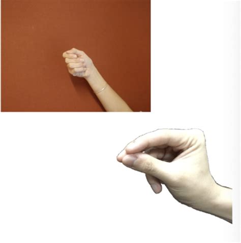 Hand Exam Flashcards Quizlet