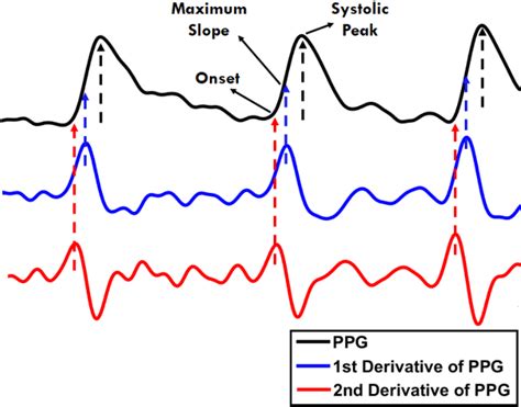 Figure 1 From Robust Interbeat Interval And Heart Rate Variability Estimation Method From
