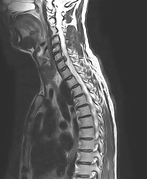 ხერხემლის პრობლემები საერთო თემა თბილისის ფორუმი