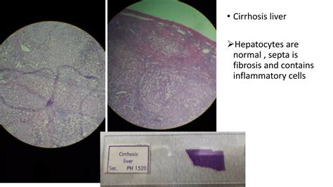 Pathology Slides Of Git System Pptx Digestive Disorders Diseases