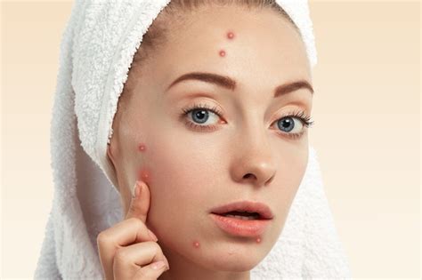 «Проблемы с печенью врач рассказала как прыщи на лице указывают на болезни