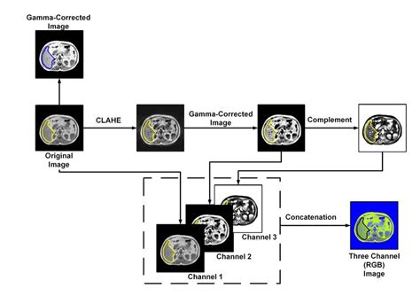 Visualization Of Image Enhancement Techniques Download Scientific Diagram