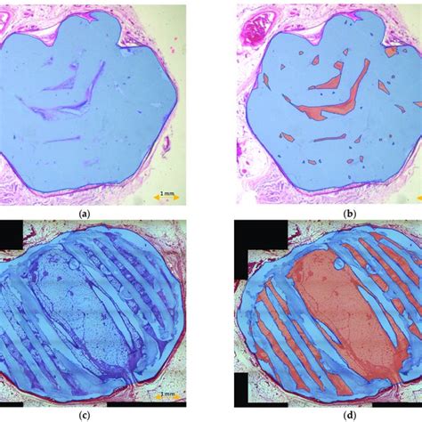 Scaffold Cross Section Surface S1 Blue And Soft Tissue Area Inside Download Scientific