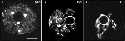 Three Types Of Chromatin Configurations In Mouse Oocytes Nuclei The Download Scientific