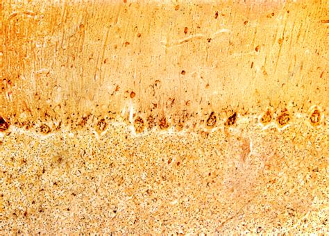 Cerebellar Cortex Light Micrograph Stock Image C059 7790 Science Photo Library