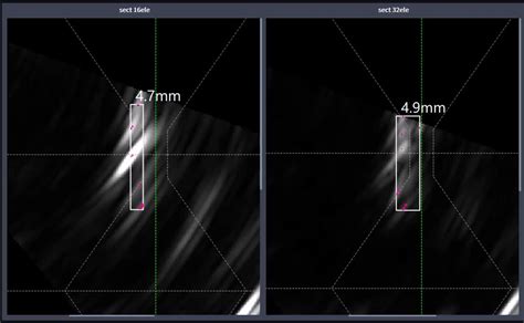 The Tip Diffraction Sizing Technique Provides Accurate Sizing Results The Tip Diffraction Sizing Technique Provides Accurate Sizing Results