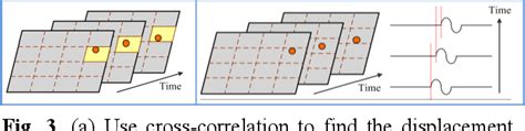 Figure 1 From Motion Artifact Elimination Algorithm With Eigen Based