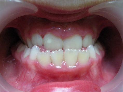 Трета сливица какво е общото между ортодонт и УНГ специалист Orthos Dent Care