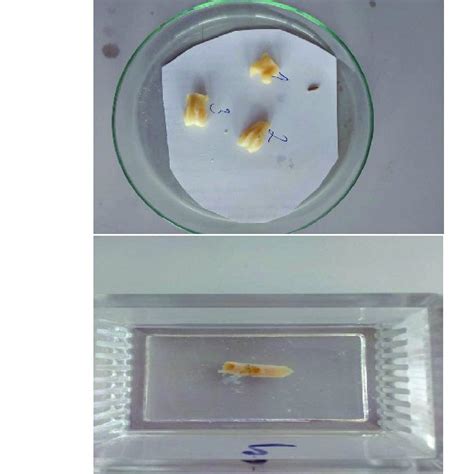 A Cut Pieces Of The Bones B Bone In Decalcification Solution