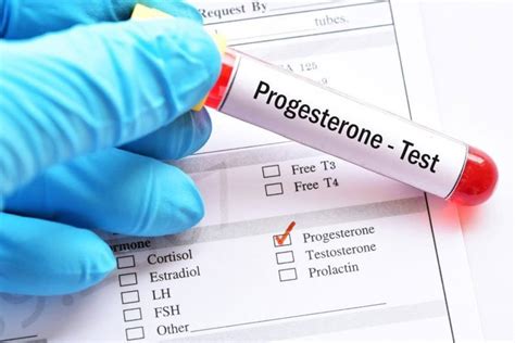 What Types Of Female Hormone Tests Are There Vinmec