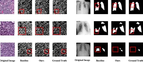 multi dimensional fusion and consistency for semi supervised medical
