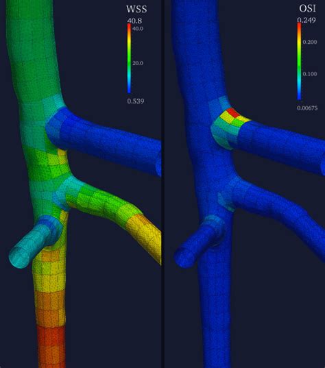vmtk the vascular modelling toolkit