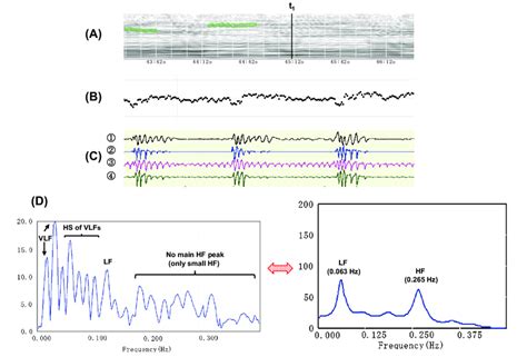 Comparison Between Instantaneous Time Frequency Analysis And Power Download Scientific Diagram