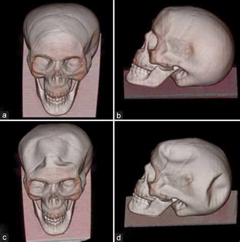 Surgical Neurology International