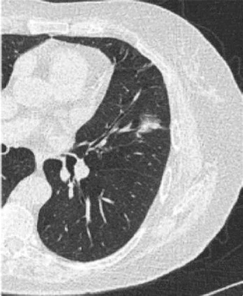 Schematic Diagram Of Nodule Types And Development Process A Ground