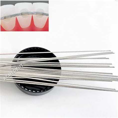 What Is Dental Wire Made Of At Caitlin Gilles Blog