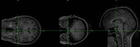 Frequently Asked Questions — Andys Brain Book 1 0 Documentation