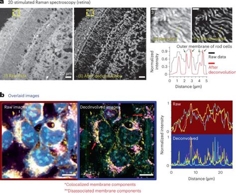 A Deconvolution Algorithm To Achieve Super Resolution Stimulated Raman Anthony Tony Fung