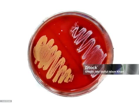 페트리 접시에 혈액 한천에 박테리아 식민지 박테리아 배양 배지 미생물 학자 박테리아 장비에 대한 스톡 사진 및 기타 이미지