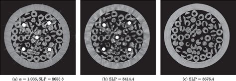 figure 1 from metal artifact reduction using iterative reconstruction