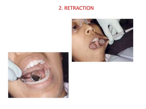 Periodontal Instrumentation Pptx