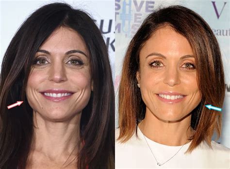 Bethany Frankel Plastic Surgery Ebnc