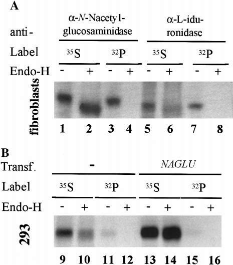 Phosphorylation Of N Acetylglucosaminidase Secreted By Human Cells A