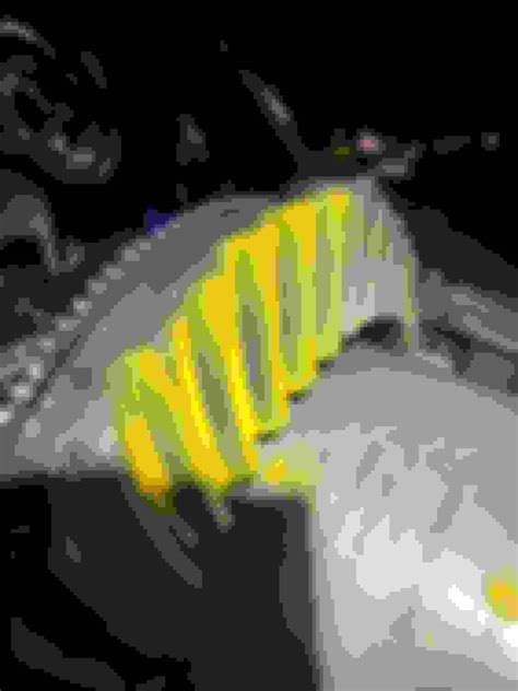 10 5 Sterling Diff Patern Page 2 Ford Truck Enthusiasts Forums