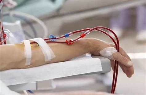 Nefropista Cuidados En El Postoperatorio De Una Fístula Para
