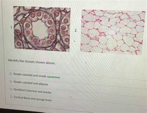 Solved Identify The Tissues Shown Above Simple Cuboidal And Simple Squamous Simple Cuboidal