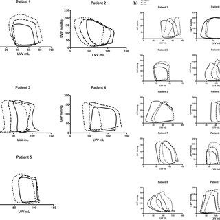 Pressurevolume Loops At Rest And On Exercise A Pressurevolume Download Scientific Diagram