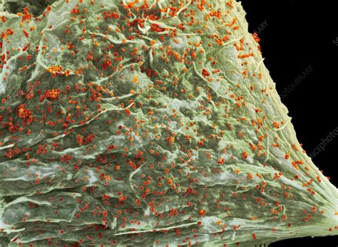 Cell Infected With Hiv Sem Stock Image C007 3158 Science Photo Library