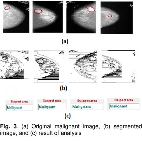 a original images with several suspicious areas b segmented