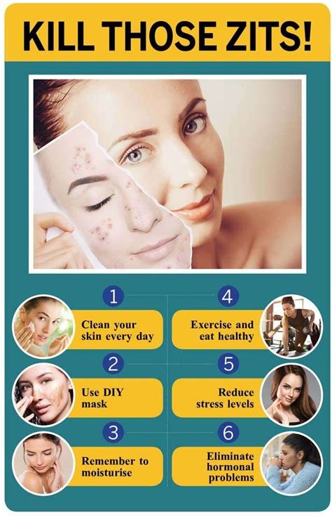 Pimples On Face Removal Tips