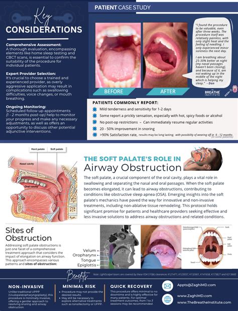 Non Ablative Laser Tissue Remodeling Zaghimd