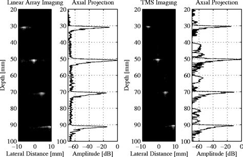 measured b mode images and axial projections of a scanned wire phantom
