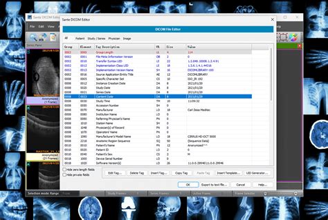 Sante Dicom Editor 软件 官方授权正版软件平台