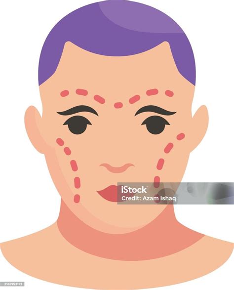 이마 주름 감소 수술 개념 이마 성형술 벡터 평면 디자인 성형 외과 의사 기호 신체 윤곽 표시 뷰티 트리트먼트 스톡