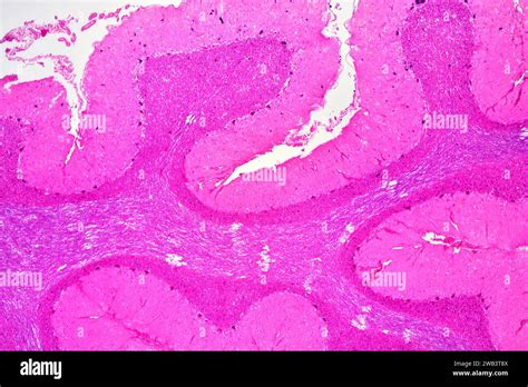 Human Cerebellum Cortex Section X30 At 10 Cm Wide Stock Photo Alamy