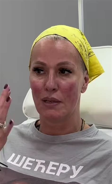 Tijana Dapčević Povećala Usne Hijaluronom