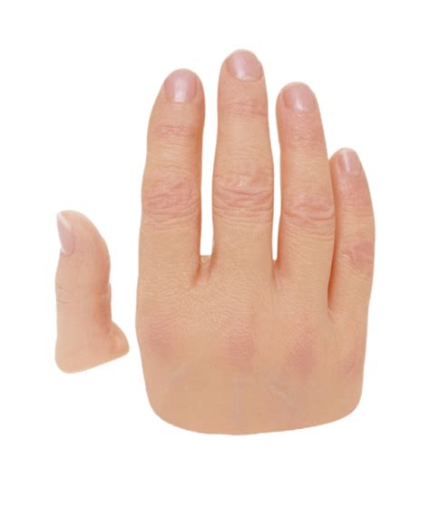 重庆锦恒假肢矫形器有限公司 重庆假肢定制生产厂家 重庆假肢纠正器 安装假肢去医院好还是机构好