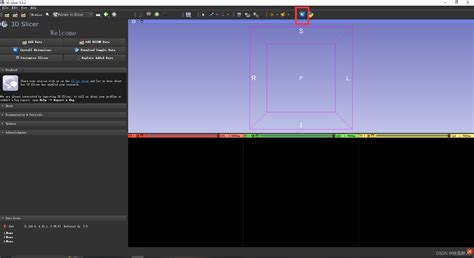 使用3d Slicer进行图像配准 Csdn博客 使用3d Slicer进行图像配准 Csdn博客