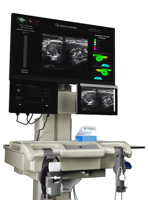Simulation Intelligent Ultrasound