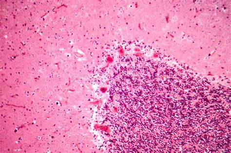 Human Motor Cortex Photomicrograph Showing Pyramidal Neurons In