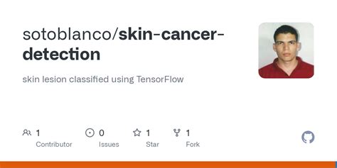 Skin Cancer Detectionnotebookipynb At Main · Sotoblancoskin Cancer
