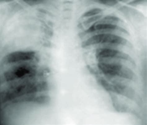 No Response After Treatment Download Scientific Diagram