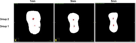 Representative Images From Different Cross Section Levels In Each
