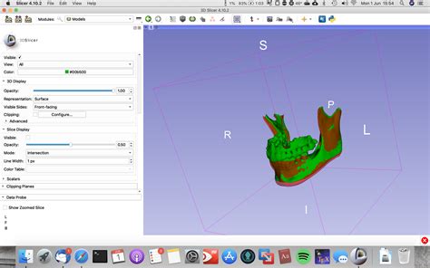 STL Models Comparison Support D Slicer Community