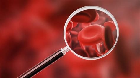 Eritrosit Rbc Nedir İdrarda Eritrosit Yüksekliği Nedir Neden Olur